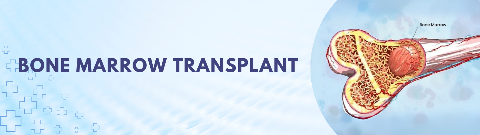 Bone Marrow Transplant in Bangalore